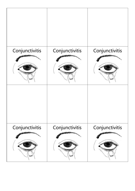 Conjunctivitis Biology Flashcards Template printable pdf download